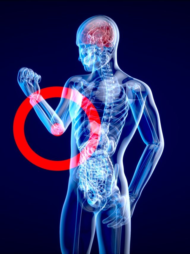 Common Tendonitis Symptoms - Nutrabay Magazine